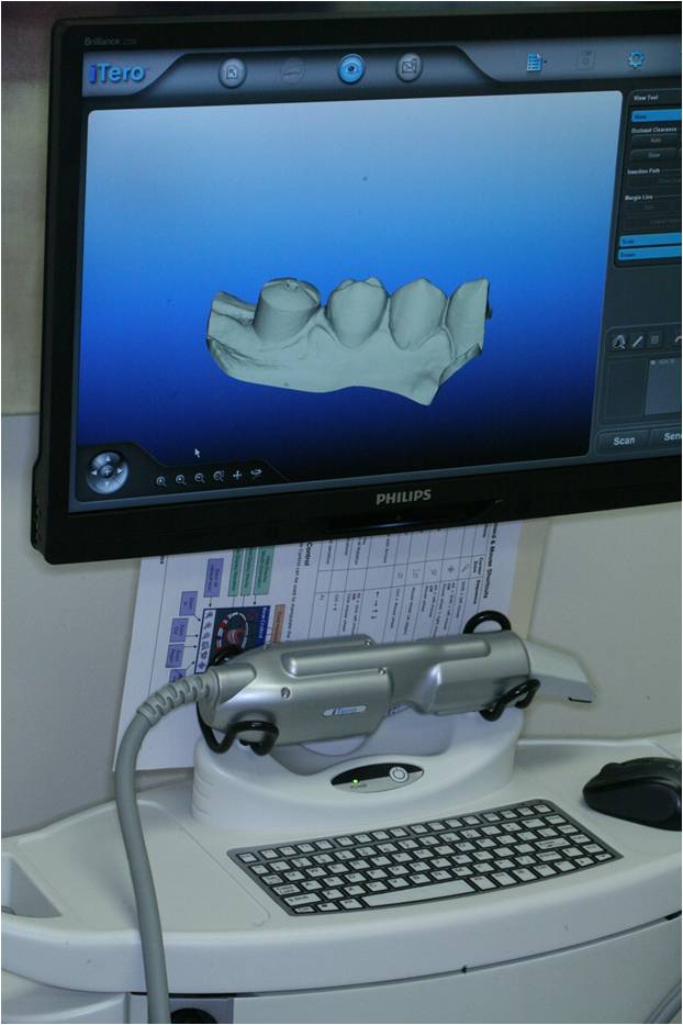 Dental Laboratory Associates, Inc. - Digital Implant Dentistry